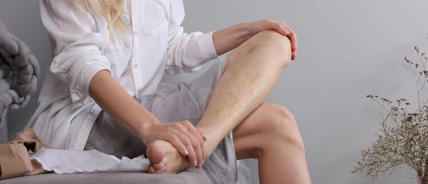 Varicosités : pourquoi apparaissent-elles et comment s'en débarrasser ...